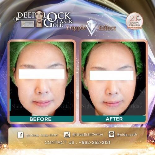 Nida Esth' Cosmetic Plastic Surgery in Bangkok, Thailand
