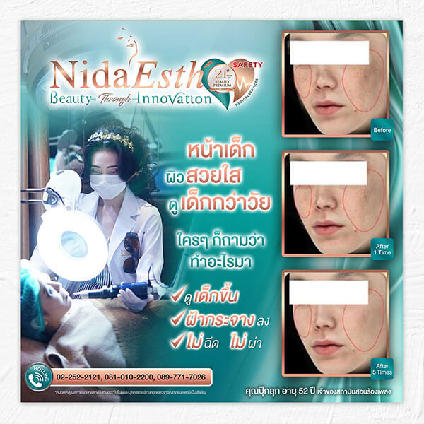 Portfolio DR.Nida LP | Nida Esthetic Cosmetic Surgery Bangkok