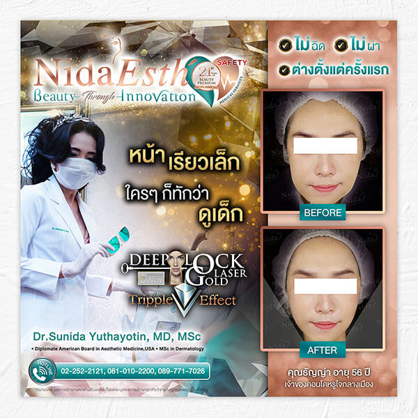 Portfolio DR.Nida LP | Nida Esthetic Cosmetic Surgery Bangkok
